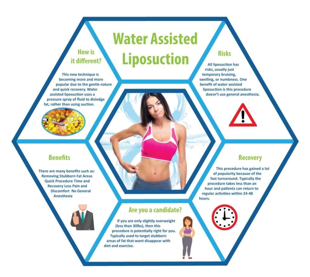 » Water Assisted Liposuction - Lipedema